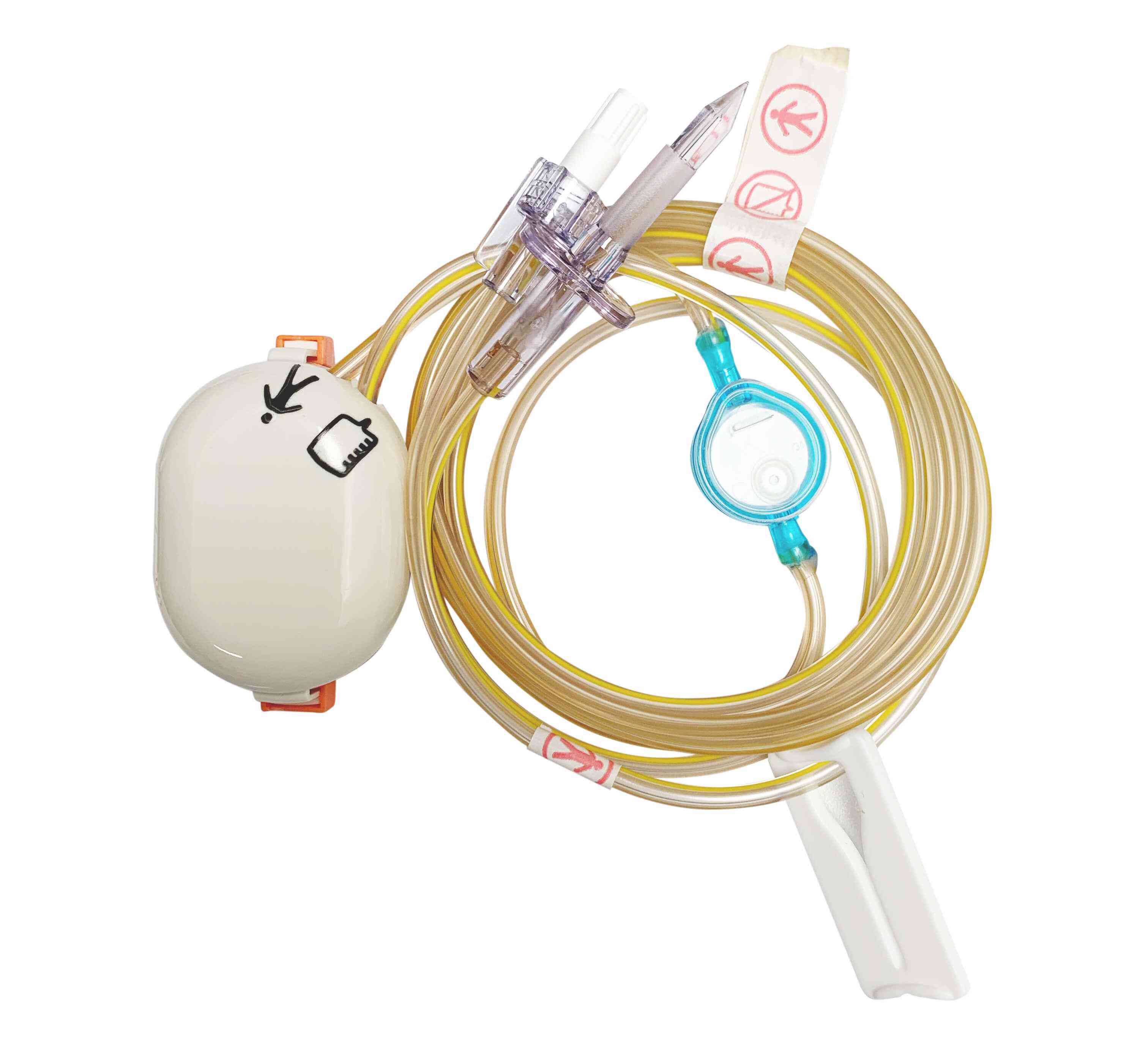 ambIT* Cassette - Filter, Spike with Yellow Striped Tubing - Avanos Medical, Inc.