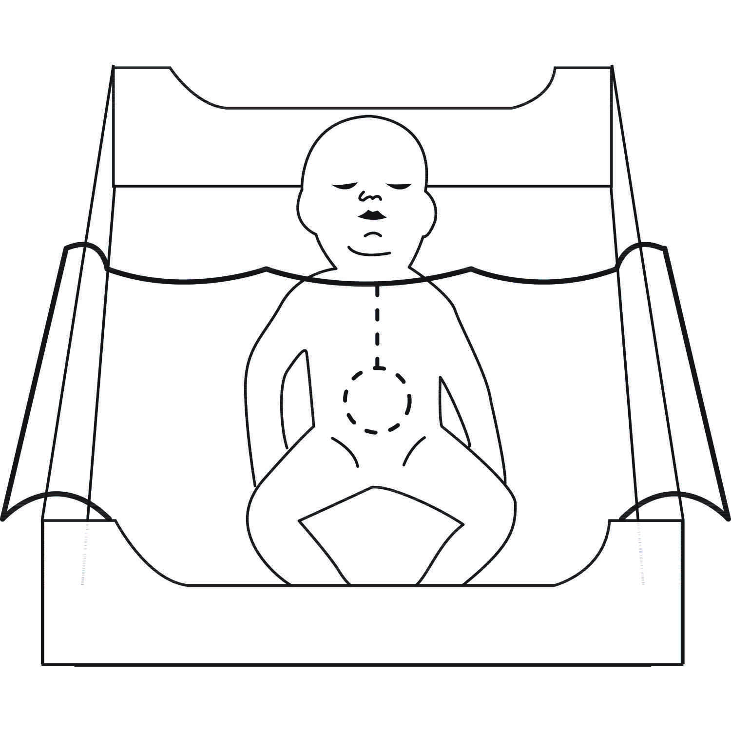 NeoDrape Fenestrated - Avanos Medical, Inc.