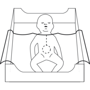 NeoDrape Fenestrated - Avanos Medical, Inc.